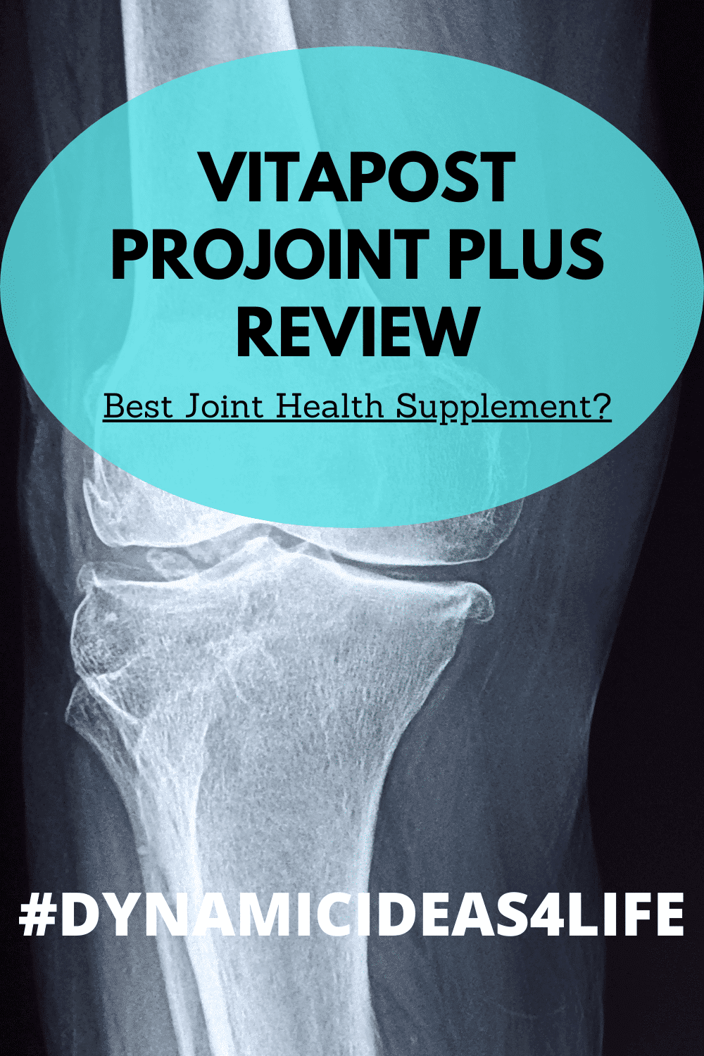 Vitapost ProJoint Plus Review - Best Supplement for Joint Health?